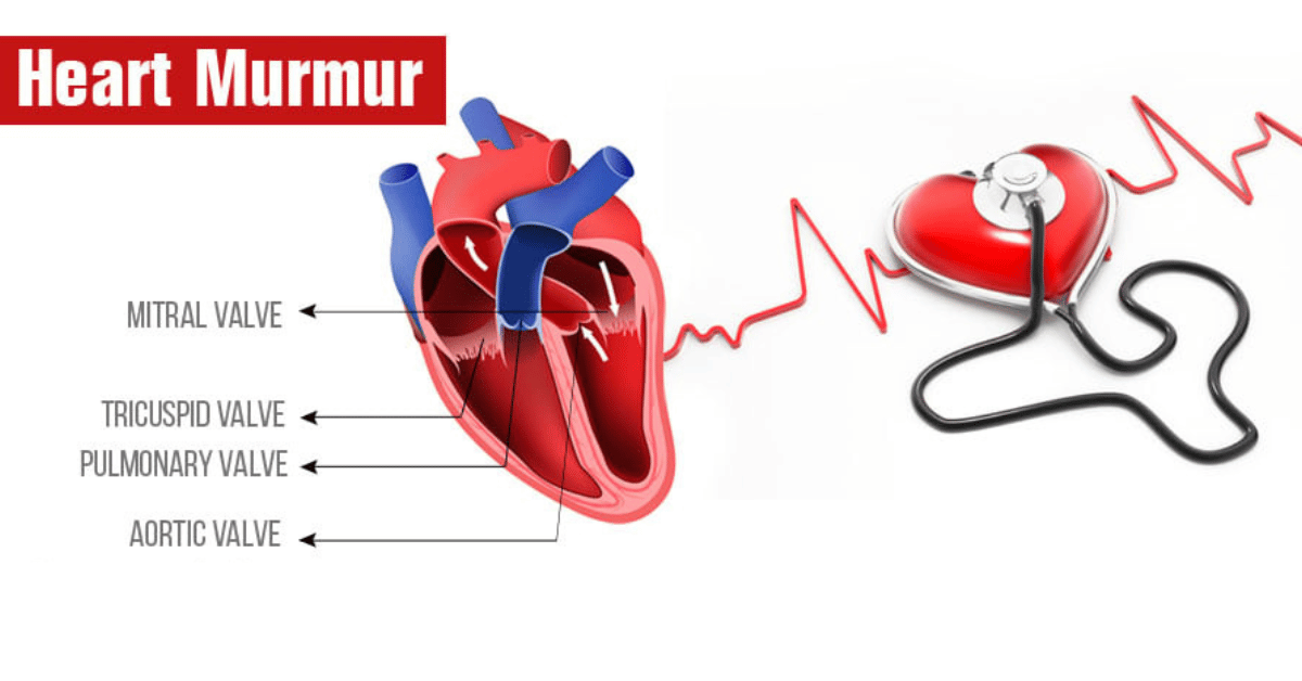 Heart Murmur Symptoms & Care